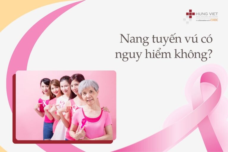 Kiến thức ung thư vú